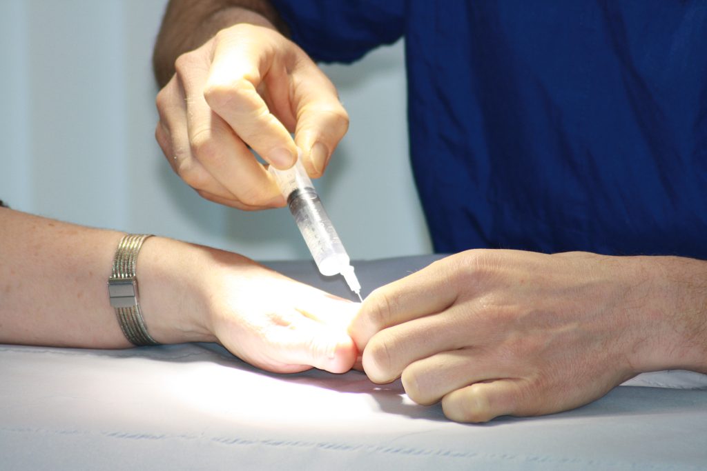 Trigger Finger - Cumbria Medical Services